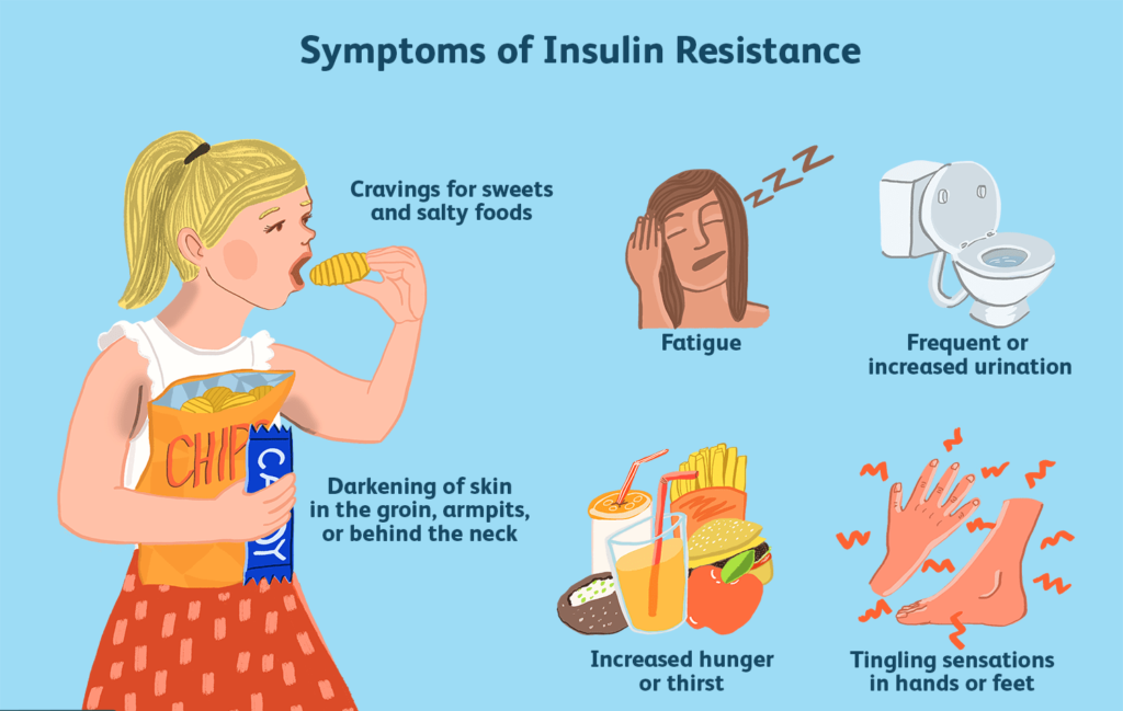 Insulin Resistance and PCOS: How They’re Connected?