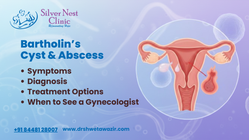 Bartholin’s Cyst & Abscess Symptoms Diagnosis Treatment Options & When ...